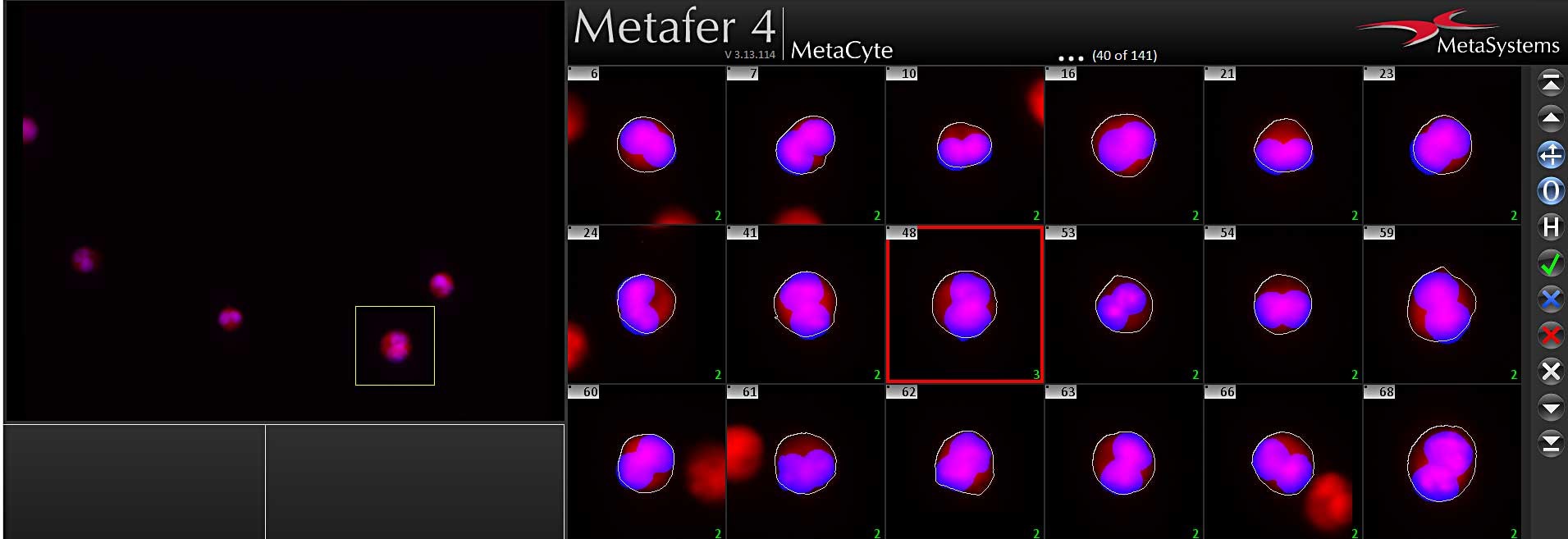 Webinar Sondas Metasystems