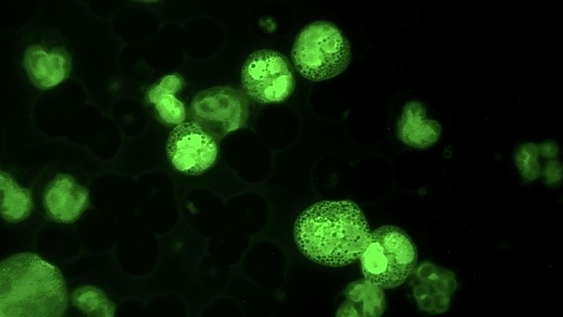 Webinar - Utilidad de la fluorescencia en el diagnóstico de microorganismos, cáncer y otras ...
